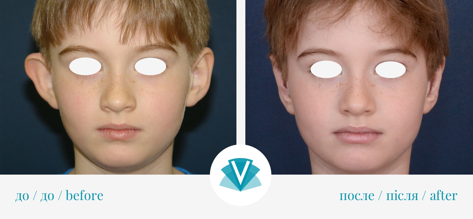 До і після операцій - клініка VIRTUS
